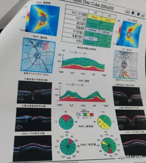 oct医学上代表什么图标