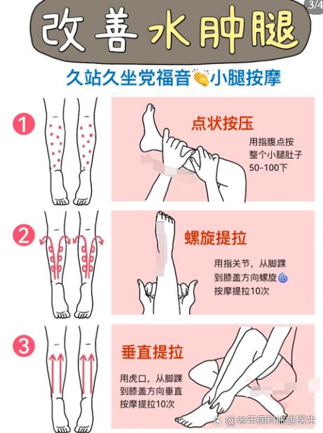 男性下肢水肿的原因图标