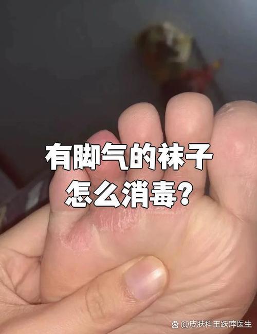 袜子用热水泡会更臭吗图标