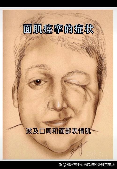 面部一边肌肉跳怎么办截图