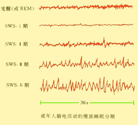 慢波睡眠和异相睡眠图标