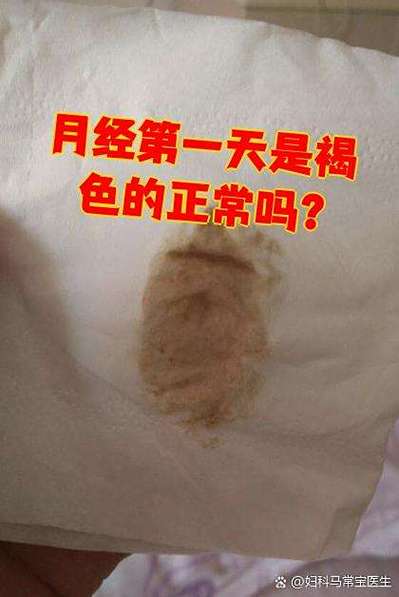 姨妈走了又来褐色的血是怎么回事图标
