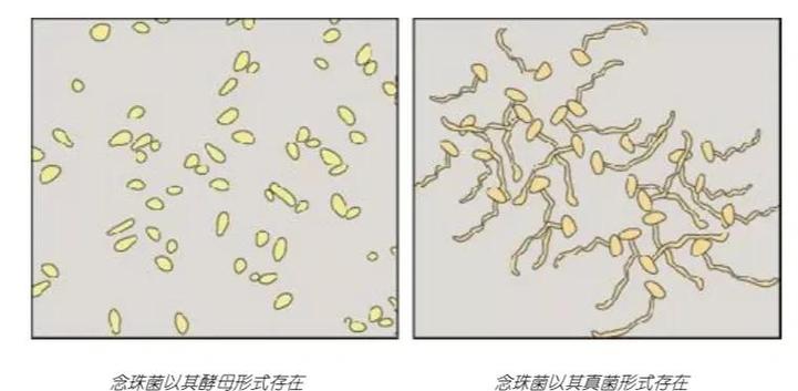 白色念珠菌感染图标