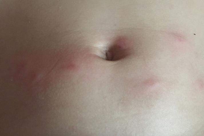 挠大腿肚脐眼痒图标