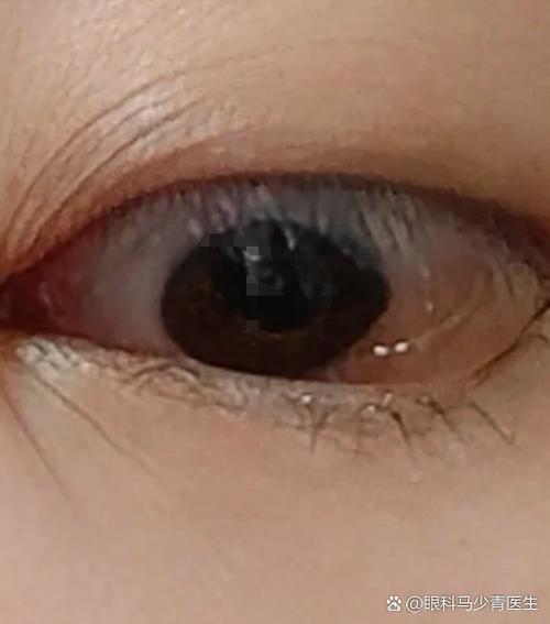 眼睛雾蒙蒙图标