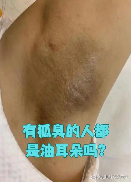 狐臭药膏图标