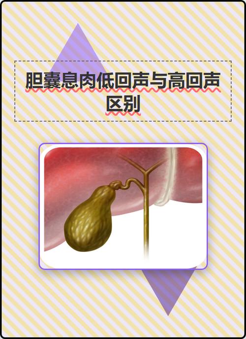 低回声和高回声区别图标
