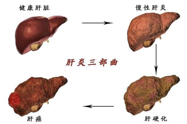 乙肝病毒对人体的影响图标