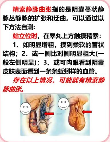 蛋蛋静脉曲张是怎么引起的 原因图标