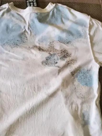 衣服上的黑点怎么去除小窍门