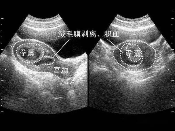 最后的胚胎安卓截图