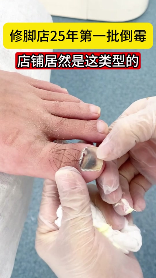 修脚排行榜前十名截图