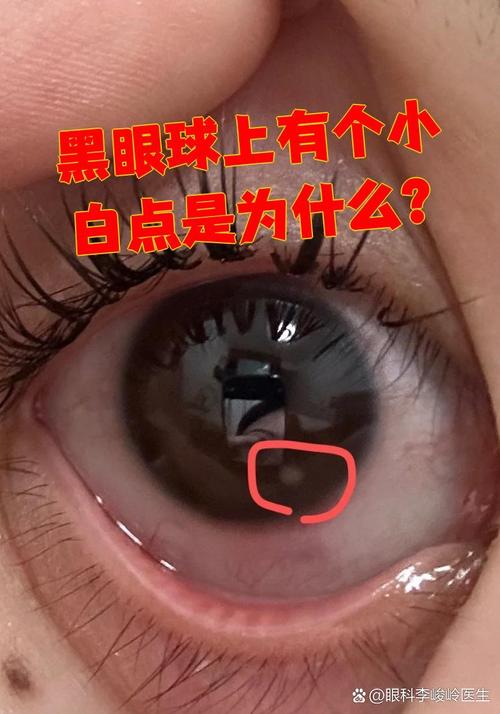 眼前出现小白点图标