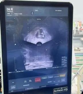 手机做b超下载截图