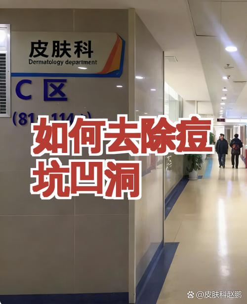 怎么把磨皮效果去掉图标