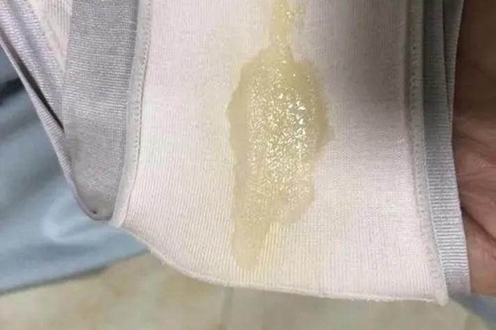 十七岁女孩下面总流粘稠物体截图