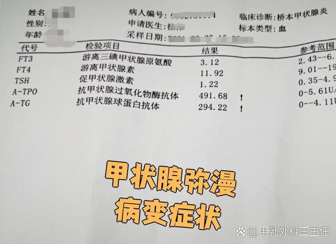 graves病是癌症中最轻的吗图标