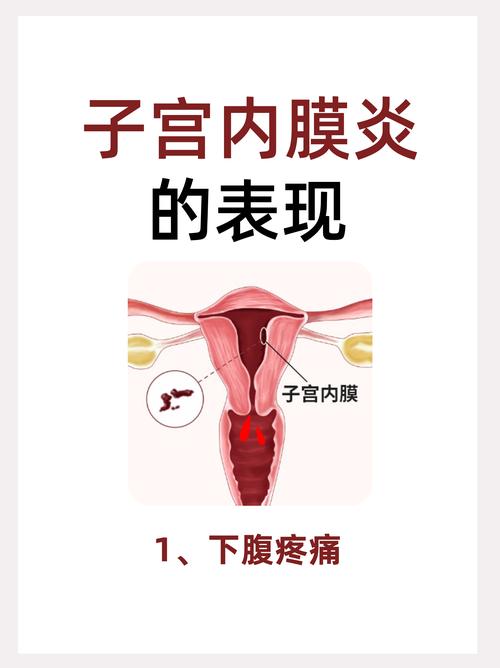 子宫粘连有什么症状截图