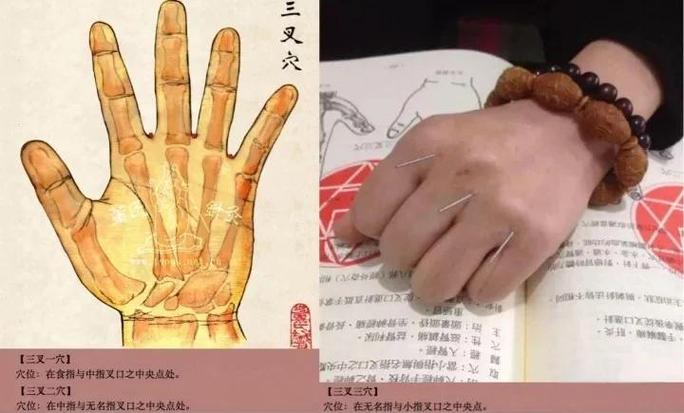 董氏刺血十大绝招图标