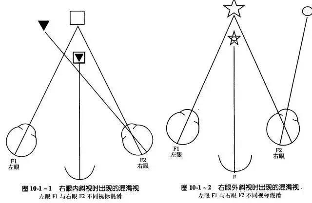 散光重影和复视的区别图标
