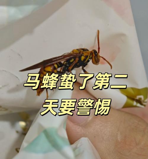 马蜂病会传染吗图标