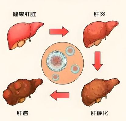 乙肝吃葡萄好不好图标