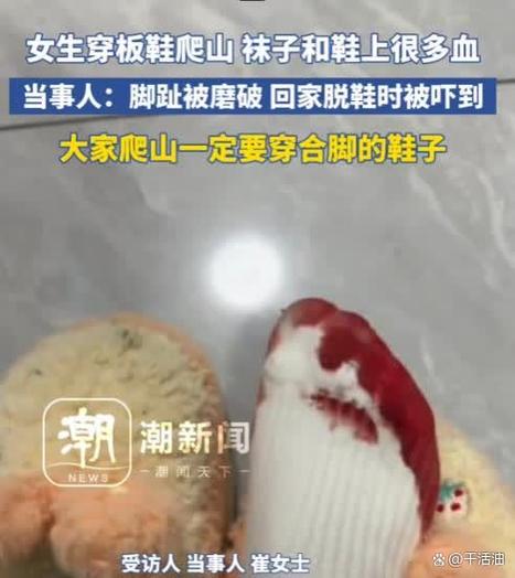 鞋子沾了血怎么清理图标