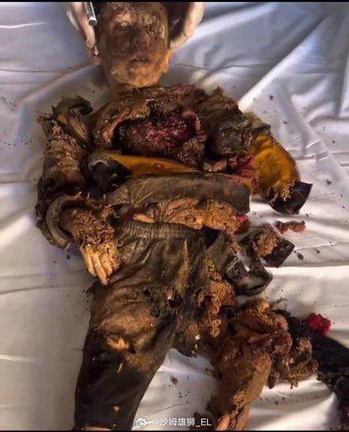 人死亡的过程图标