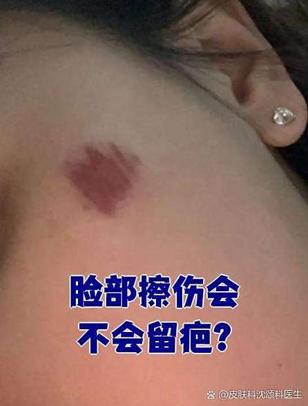 已经被涂抹的图片可以恢复么截图
