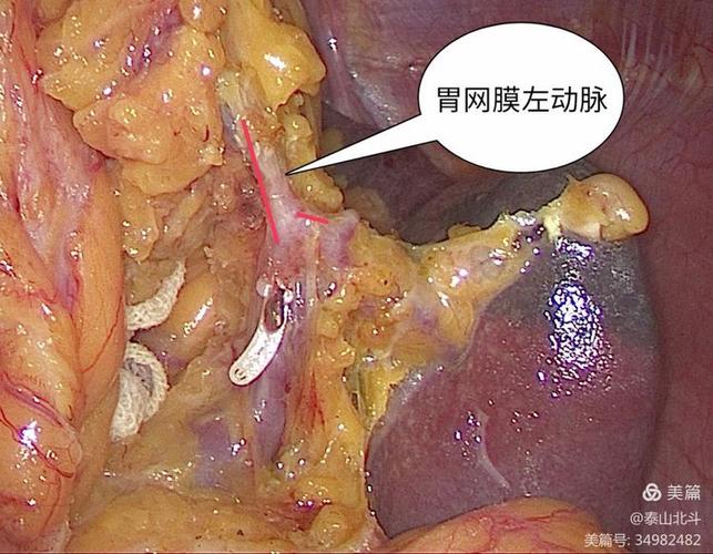 网膜转移是什么意思截图