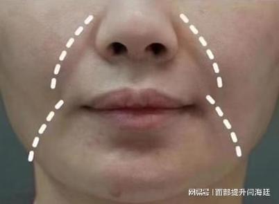 美图秀秀法令纹在哪里图标