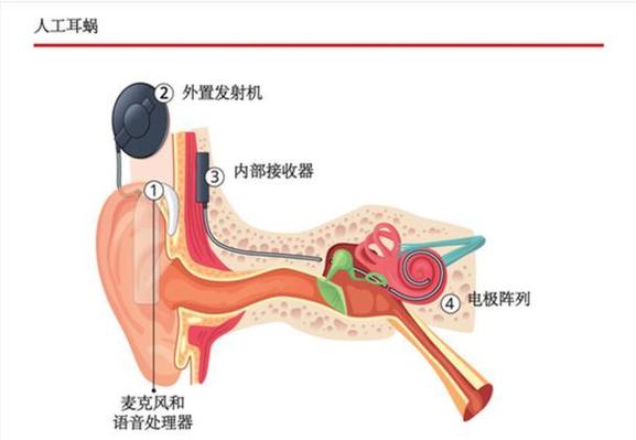 受话器怎么判断坏了截图