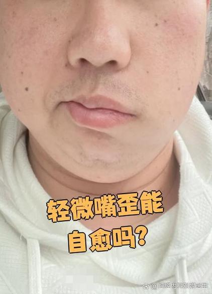 拍照嘴歪照镜子嘴不歪截图