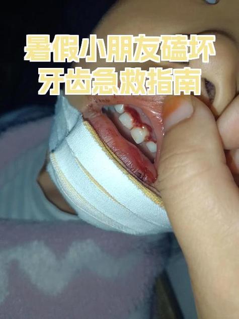 牙齿磕掉了一小块怎么办图标