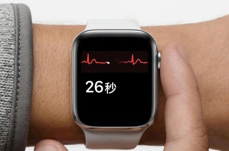 能检测房颤的手表