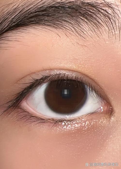 黑眼球多大比较好看截图