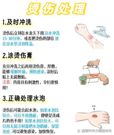 被开水烫到了怎么处理图标
