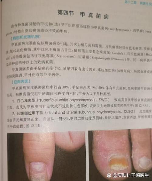 脚趾中间有一条竖线是什么截图