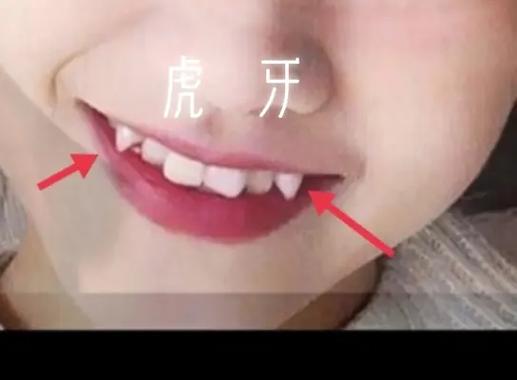 虎牙在玄学上代表什么截图