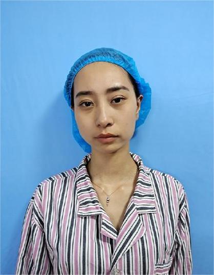 打瘦脸针一个星期脸还是没瘦缩略图