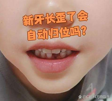 刚长的牙齿长歪了怎么办图标
