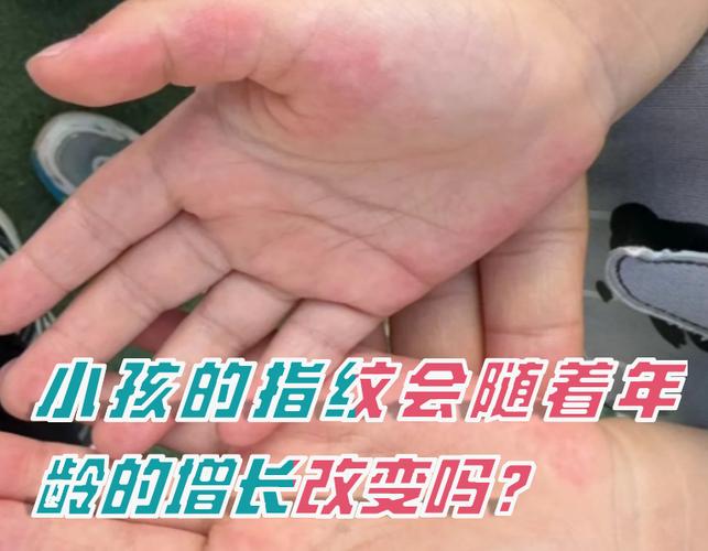 指纹会留在皮肤上吗图标