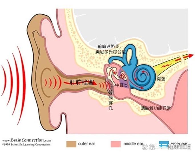 耳朵听不见了图标