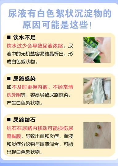 尿液是白色的怎么回事截图