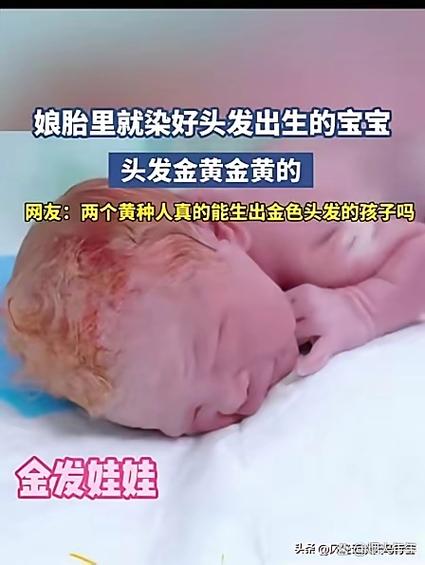为什么头发会变黄