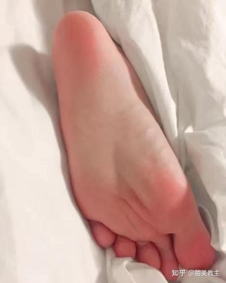 脚底特别痒没有脚气图标