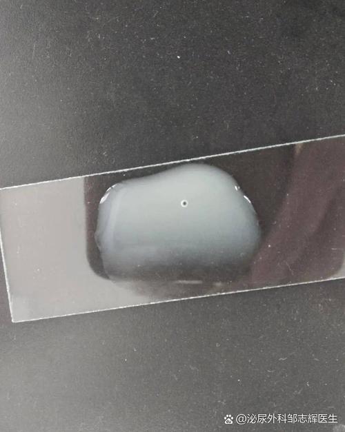 一直流白色液体是什么原因图标