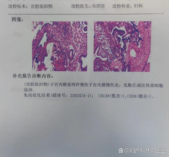 做宫腔镜的危害图标