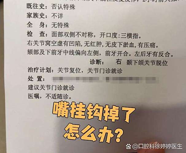 挂钩掉了能张嘴吗图标