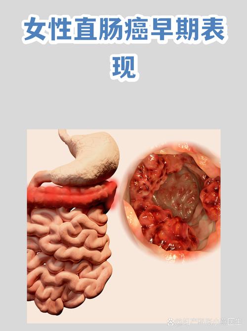 女生拉稀拉肚子图标